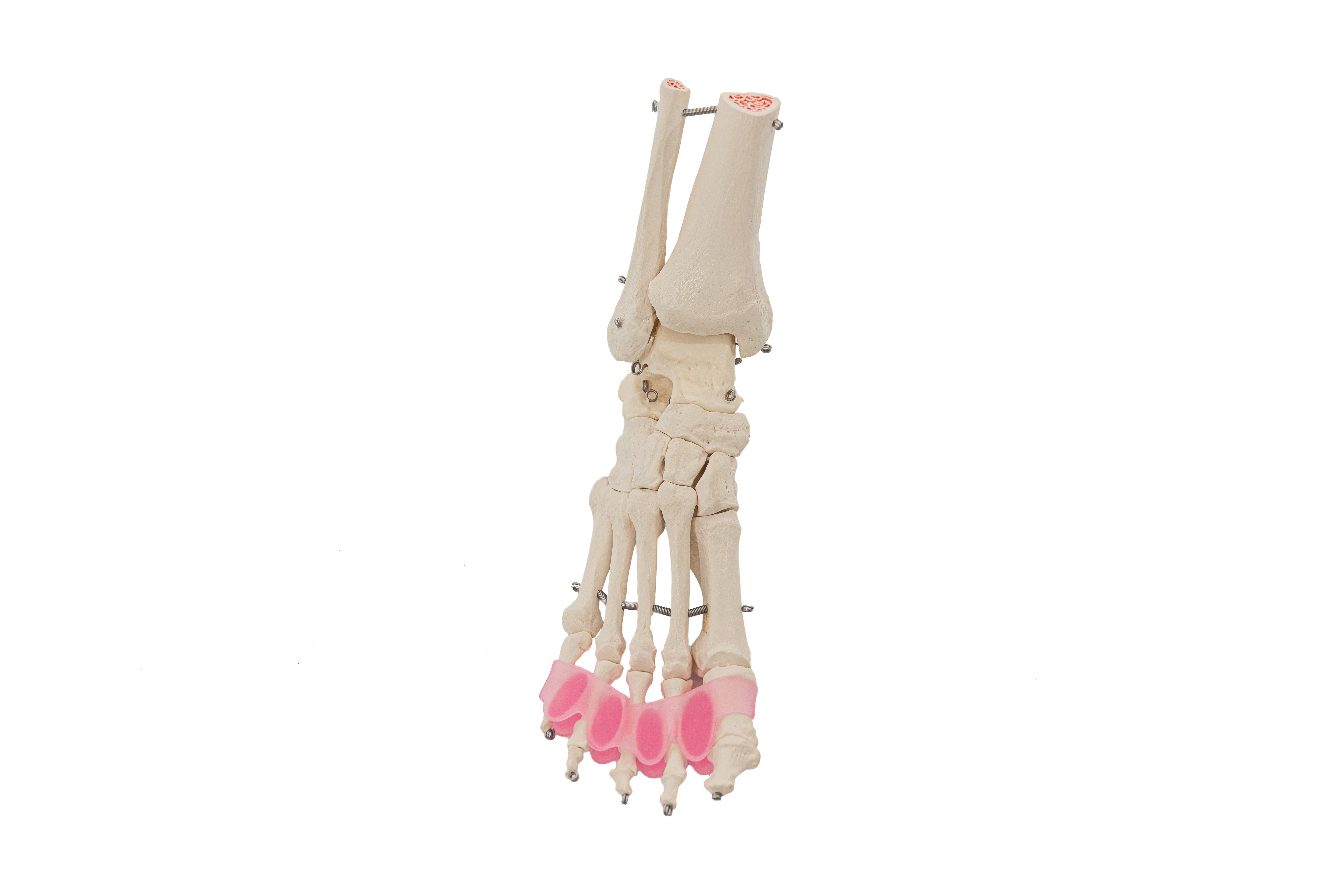 Toe Spacers for Bunions, Bunionettes, Claw Toes, Hammer Toes and Foot ...